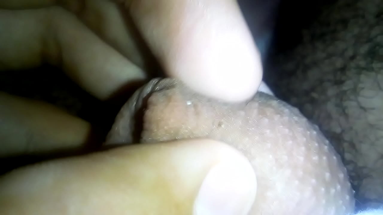 ¿se Follarían Así El Peneand Glándulas De Fordyce Andno Enfermedadesand Ni